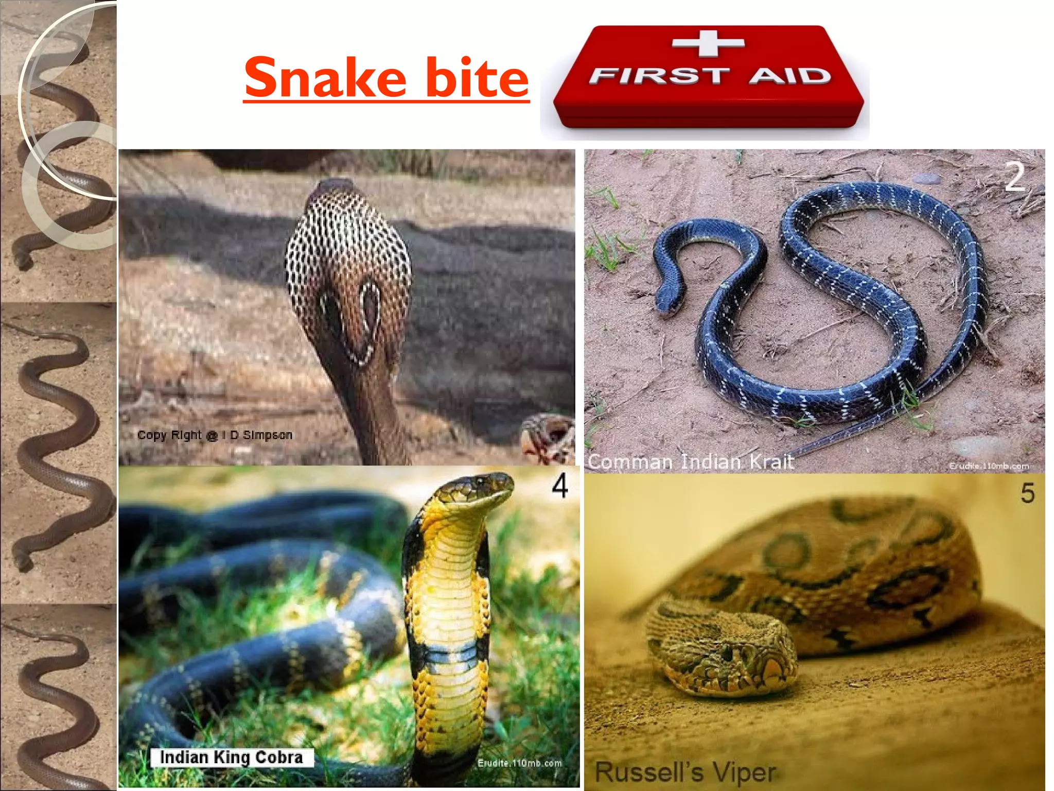 First aid on snake bite | PPT