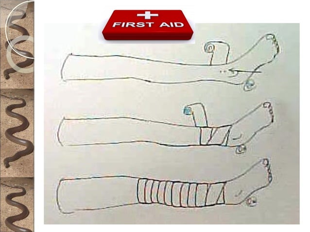 First aid on snake bite | PPT