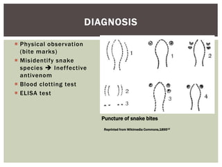 Snake bites - Neglected Disease | PPT