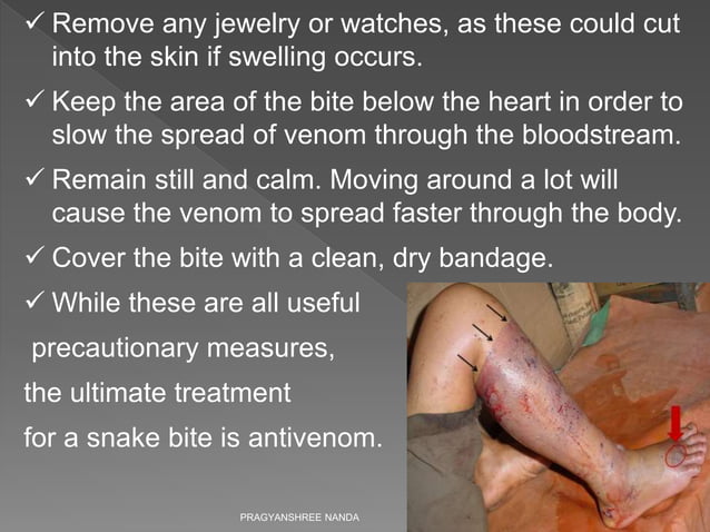 Snake bites | PPT