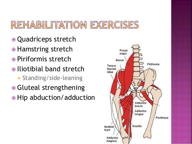 Snapping hip syndrome