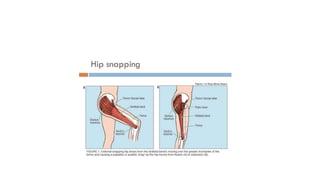 Snapping hip syndrome | PPTX