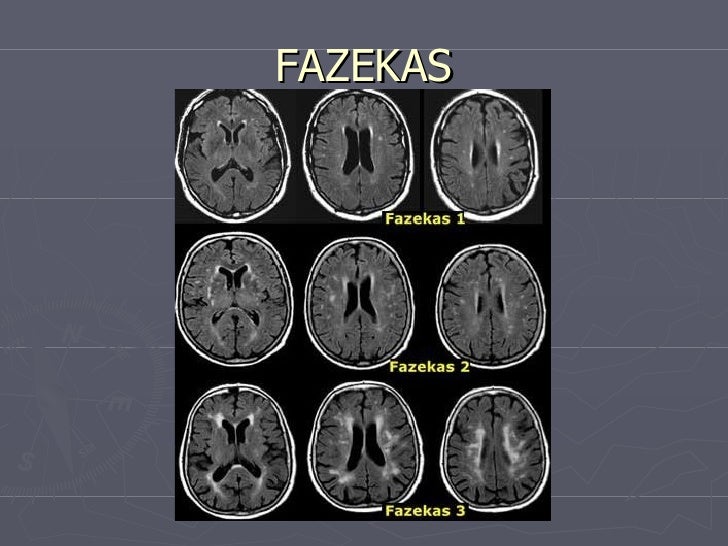 Snc clase episodio ii