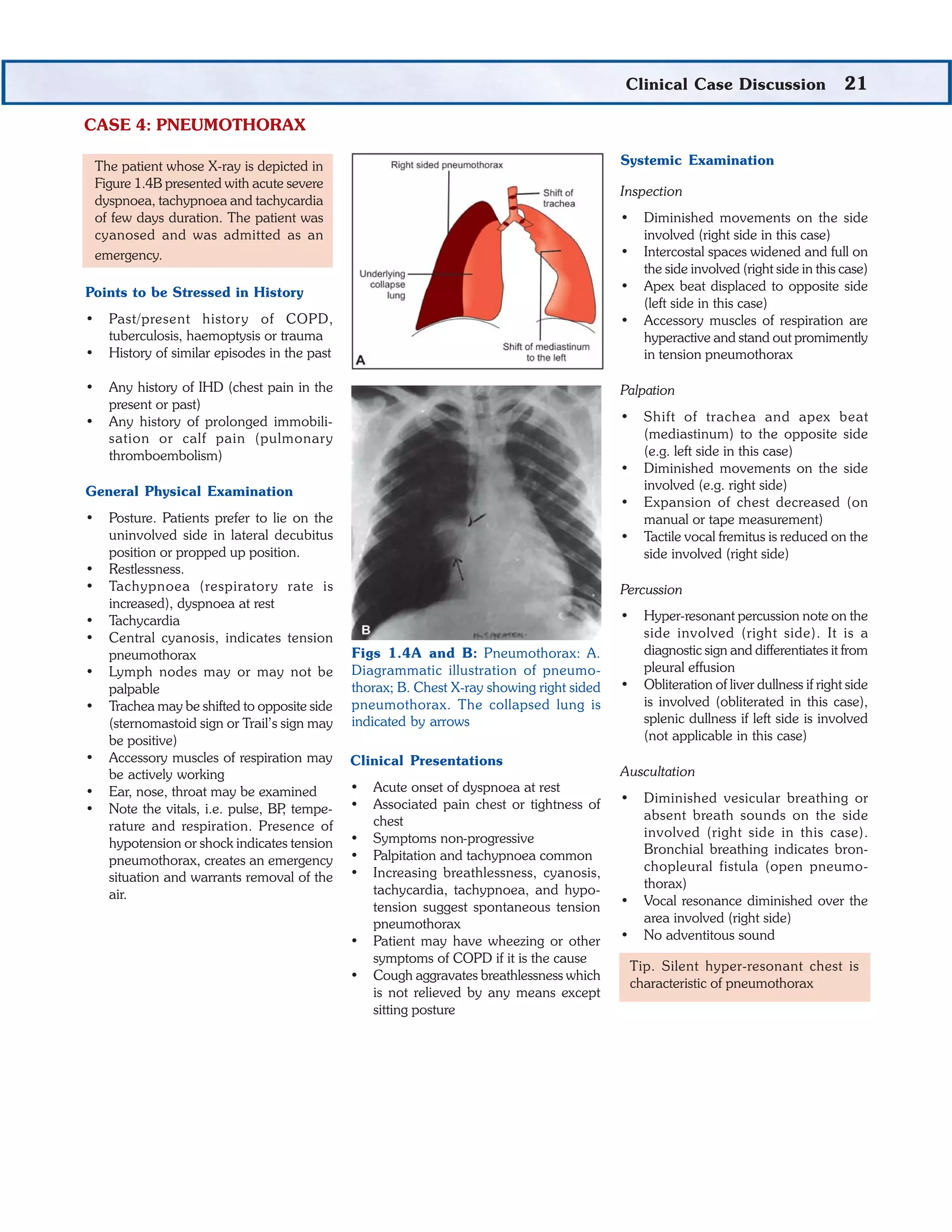 Sn chugh bedside medicine without tears | PDF