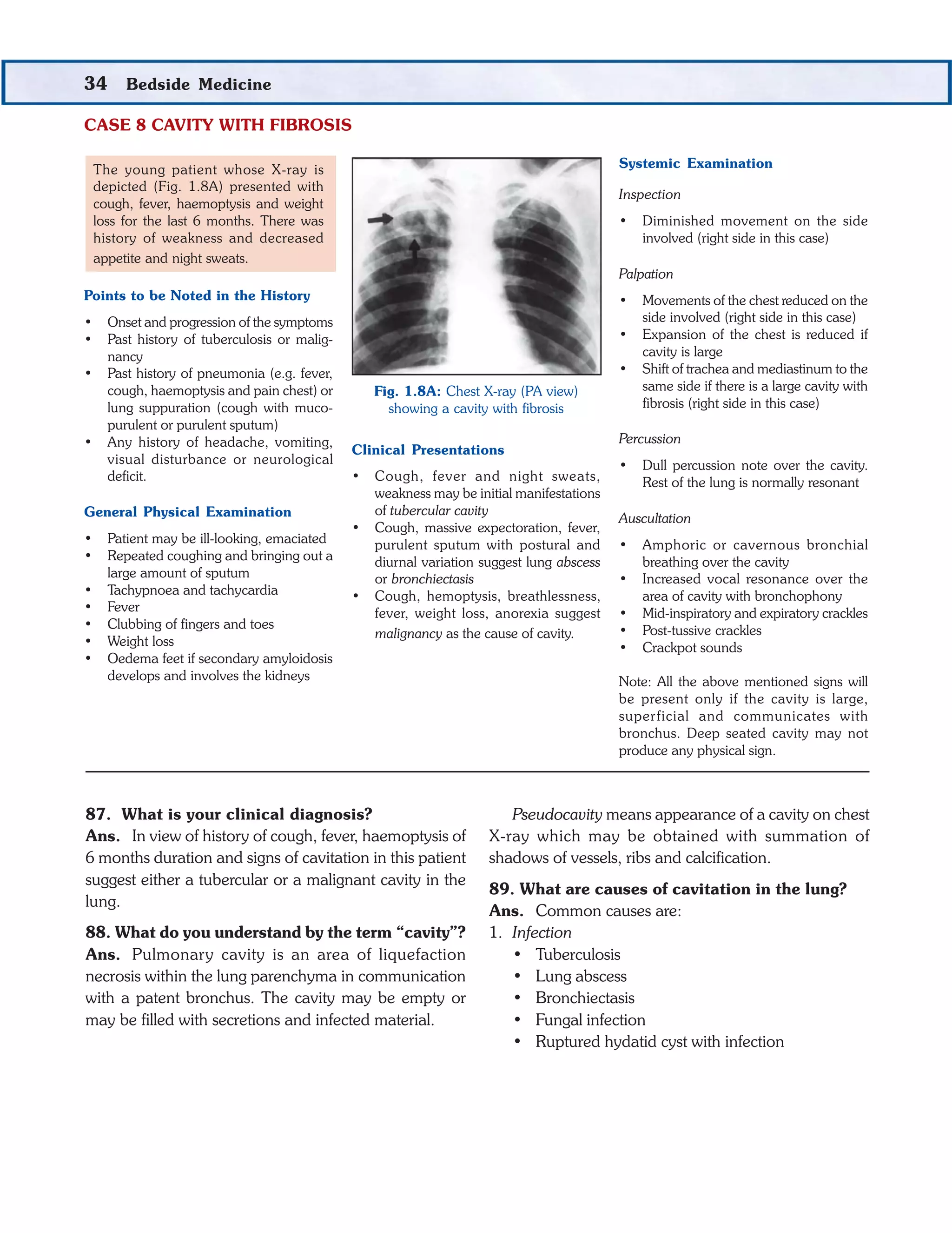 Sn chugh bedside medicine without tears | PDF