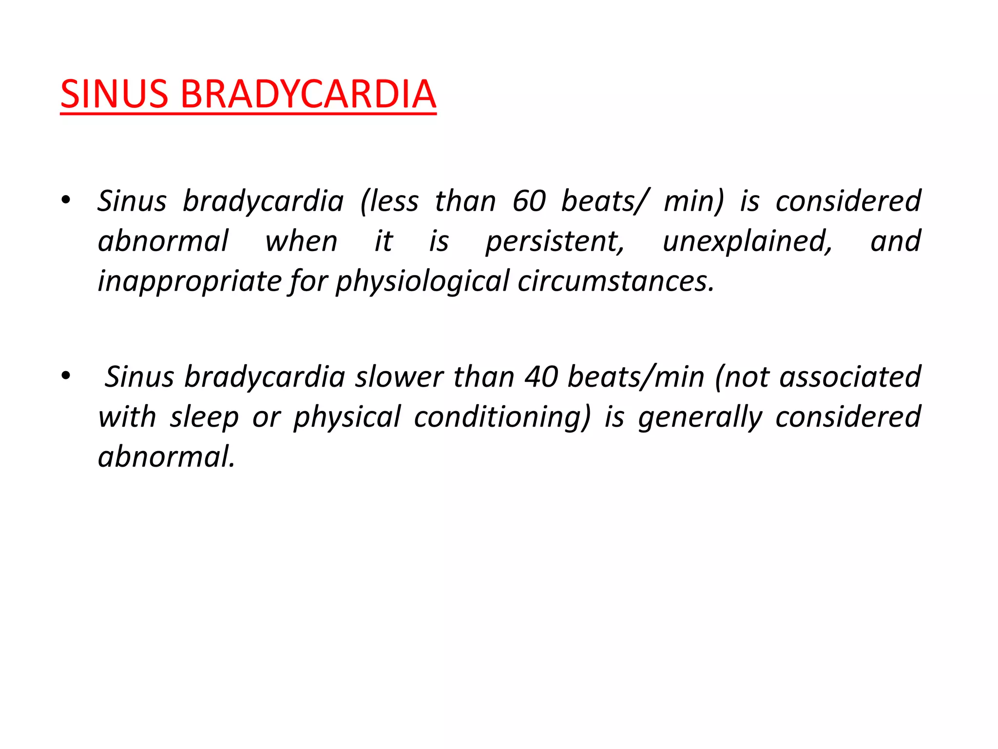 Sinus Node Dysfunction | PPT Sinus Node Dysfunction | PPT