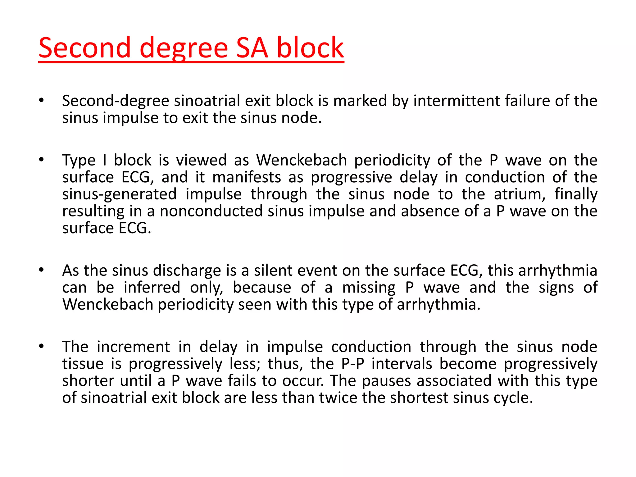 Sinus Node Dysfunction Pptx