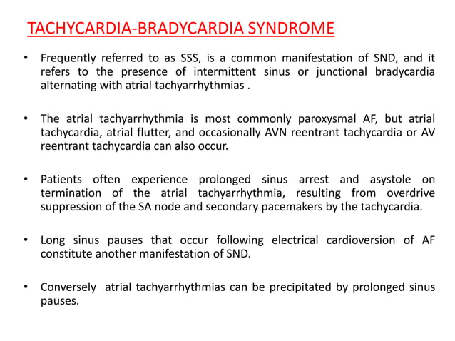Sinus Node Dysfunction | PPTX