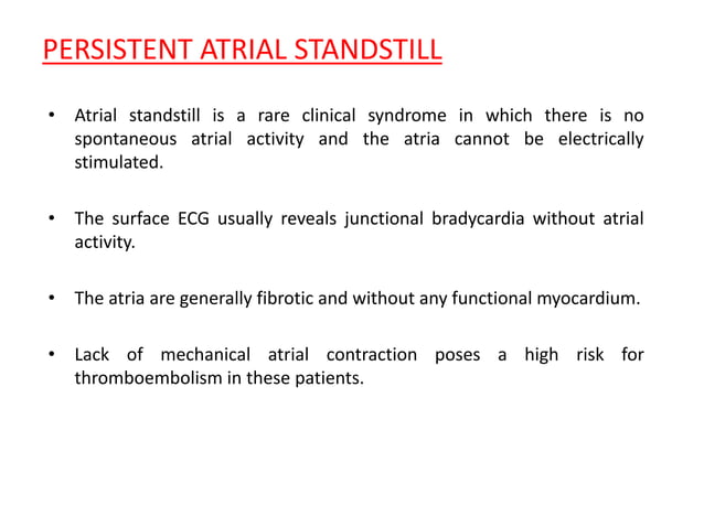 Sinus Node Dysfunction | PPT Sinus Node Dysfunction | PPT