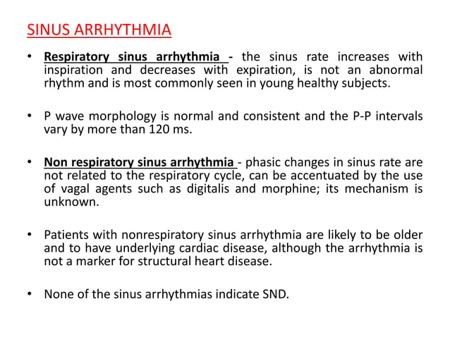 Sinus Node Dysfunction | PPTX