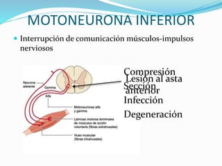 SÍNDROME-DE-MOTONEURONAS.pptx