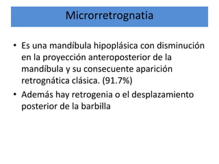 Síndrome de Pierre Robin (Etiología y clínica) | PPTX