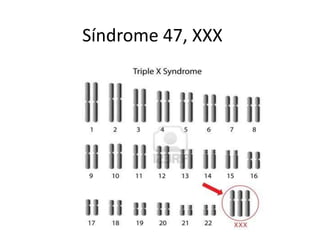 Síndrome 47, xxx | PPTX