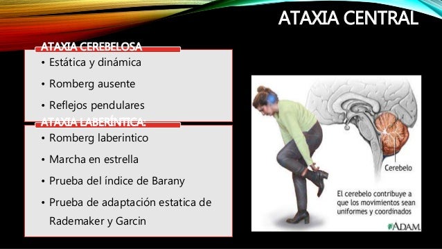 Que Es Ataxia Cerebelosa - Marcus Reid