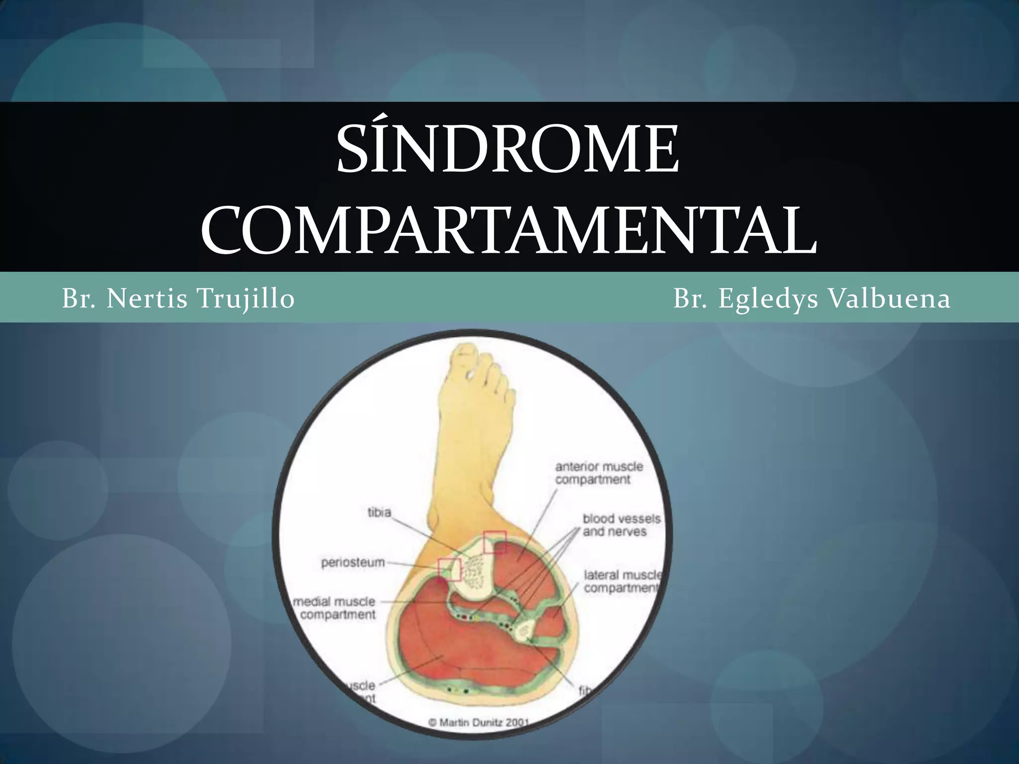 Síndrome compartamental | PPT