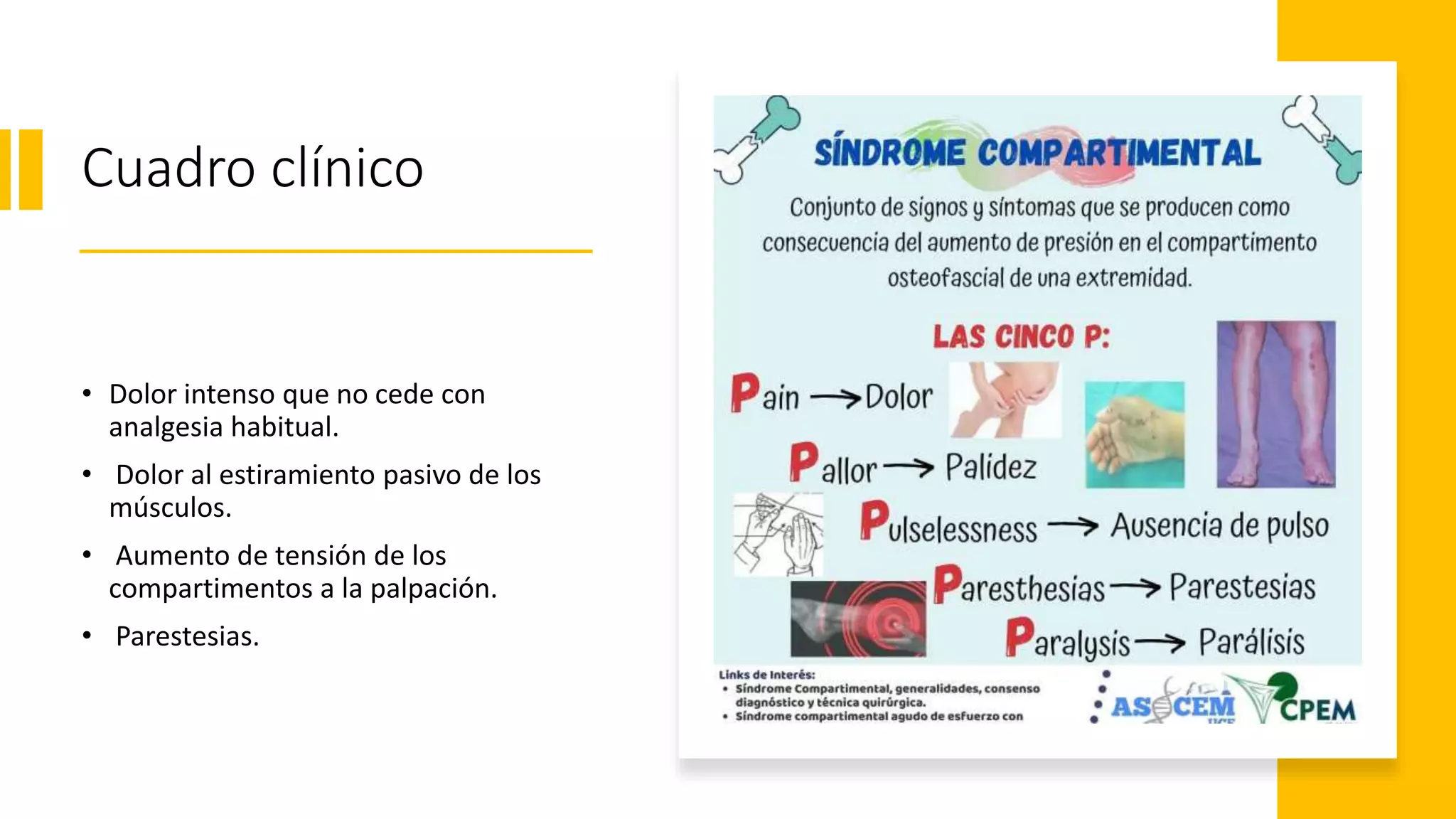Síndrome compartimental.pptx