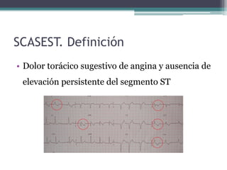 Síndrome coronario agudo | PDF