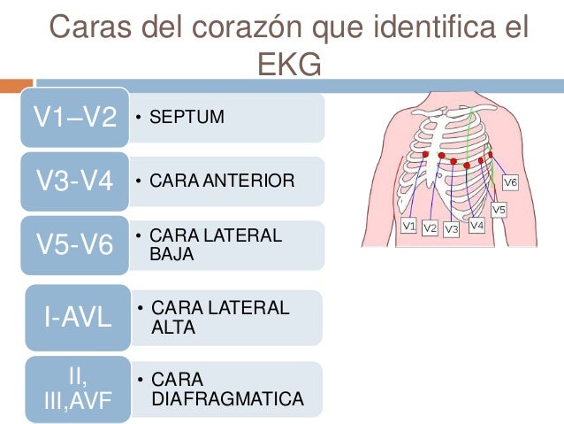 Síndrome coronario agudo