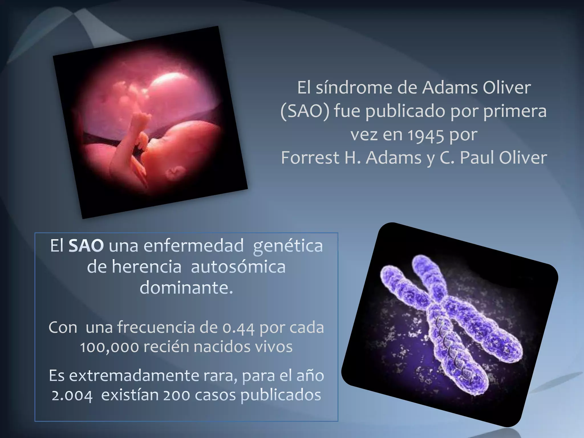SÍNDROME DE ADAMS OLIVER | PPTX