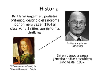 Síndrome de Angelman | PPT