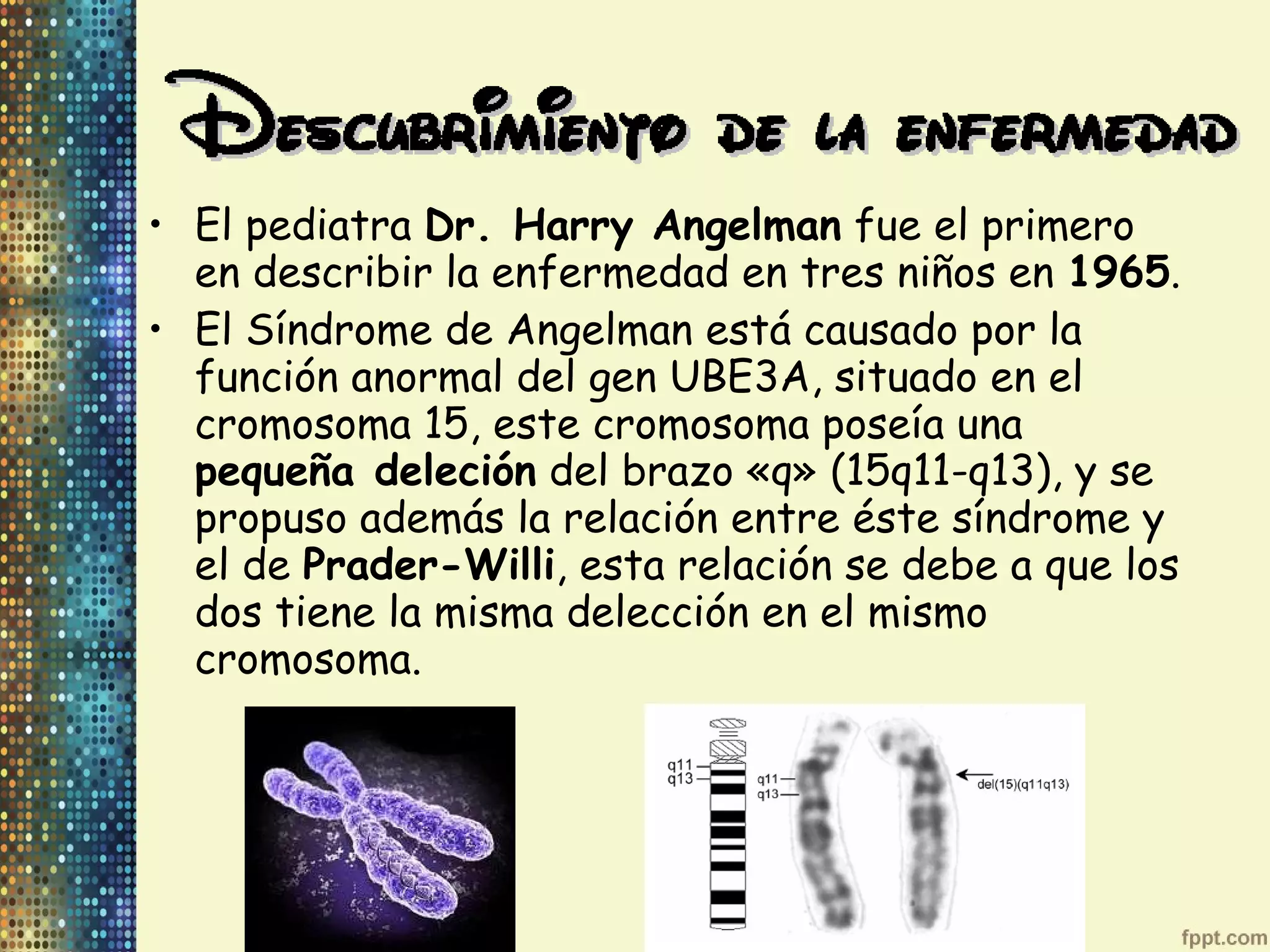 Síndrome de Angelman | PPT