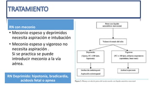 Síndrome de aspiración meconial | PPTX