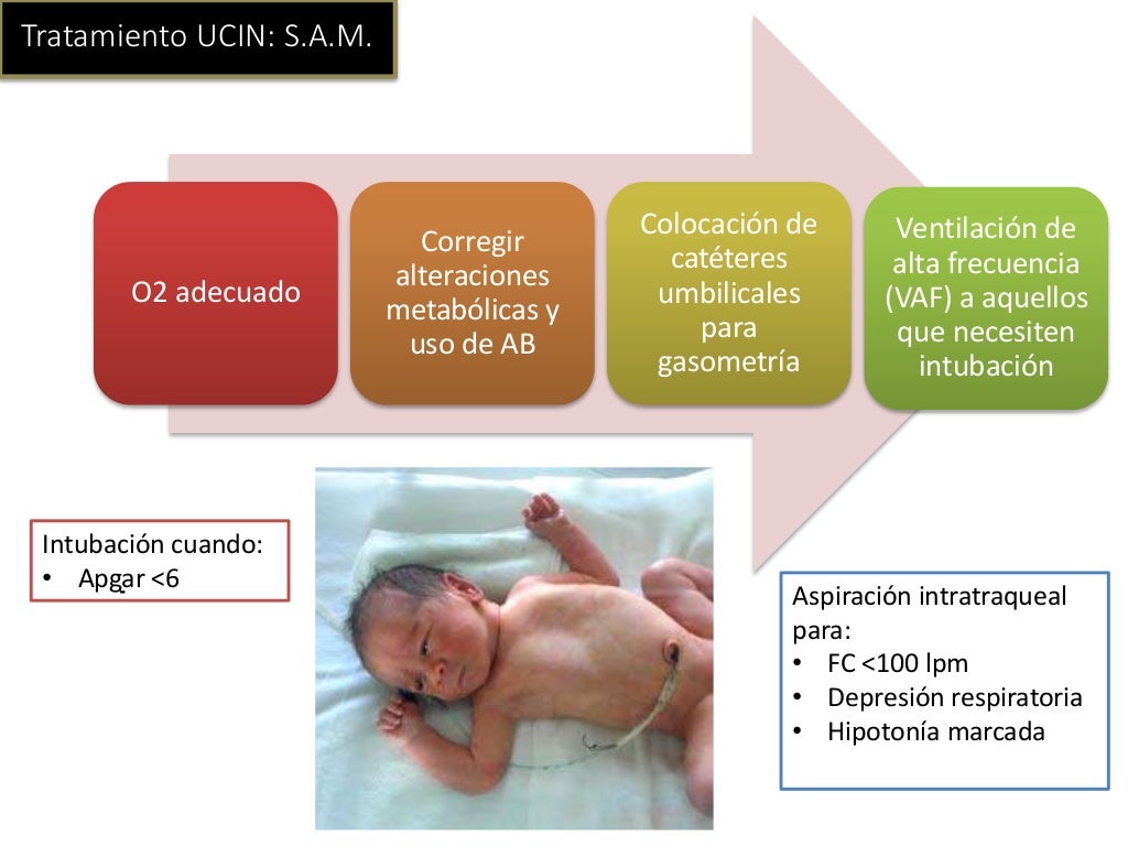 Sindrome De Aspiracion Meconial - vrogue.co Sindrome De Aspiracion Meconial - vrogue.co
