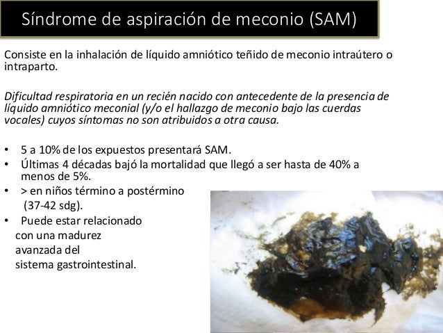 Síndrome de aspiracion de meconio