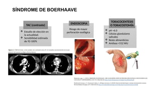 SÍNDROME DE BOERHAAVE GASTROENTEROLOGIA.pptx