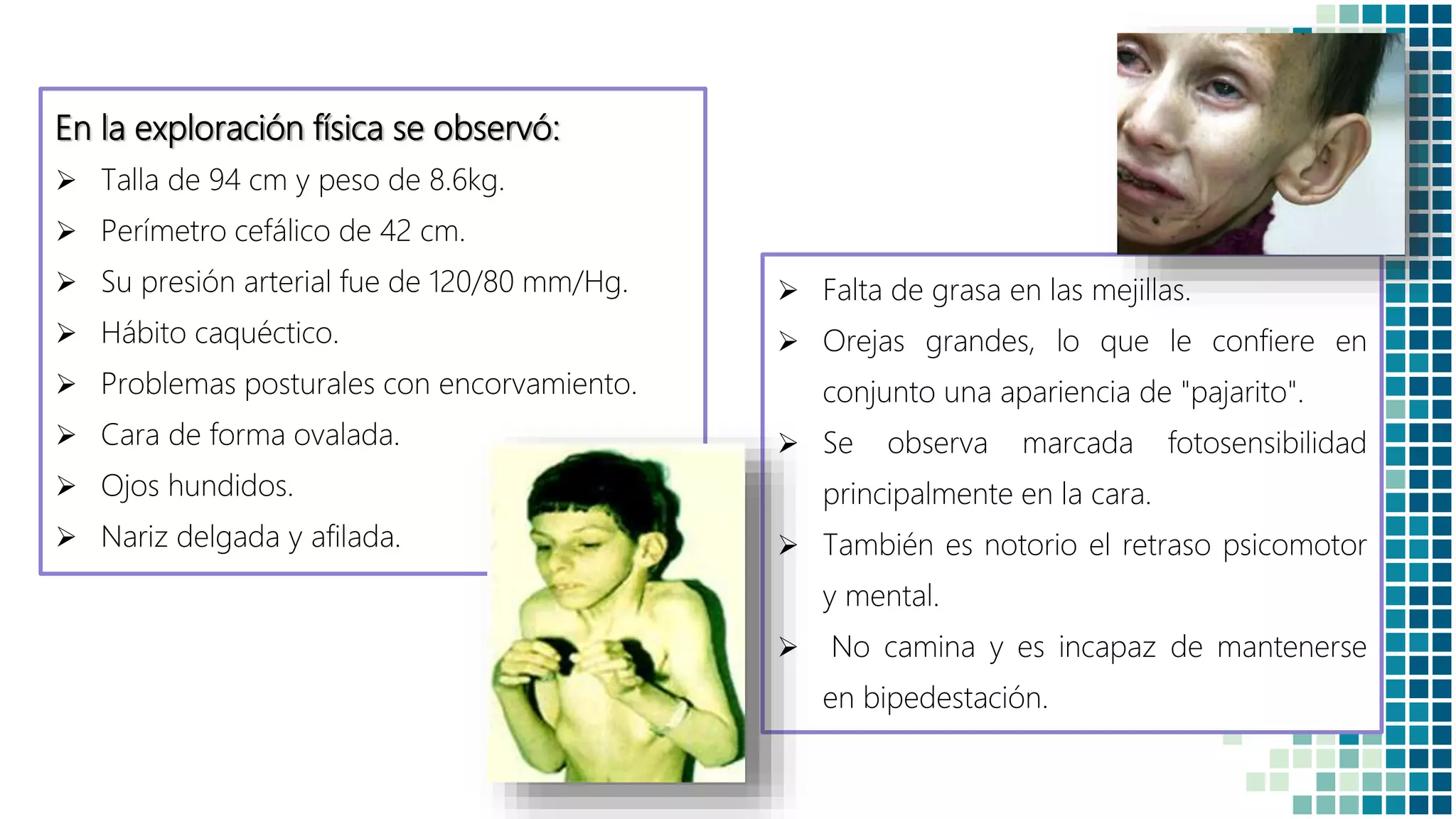 Síndrome de Cockayne (Genética) | PPT