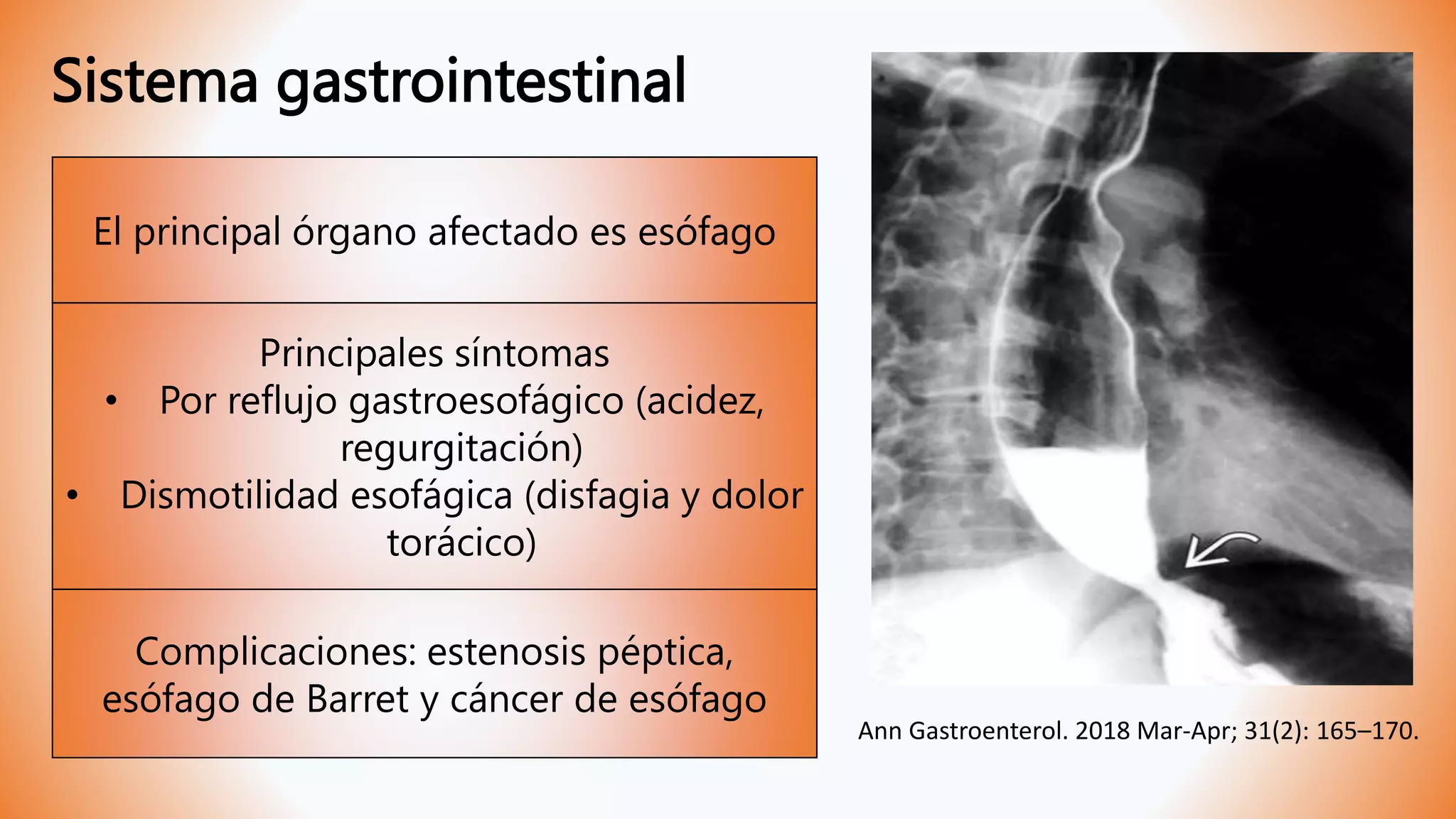Síndrome de CREST | PPTX | Skin and Dermatology | Diseases and Conditions