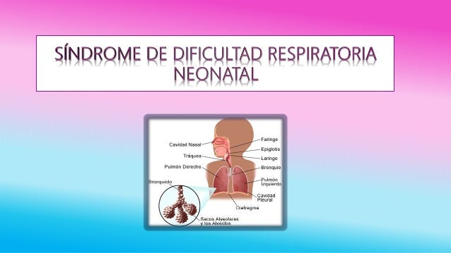 Síndrome de dificultad respiratoria neonatal