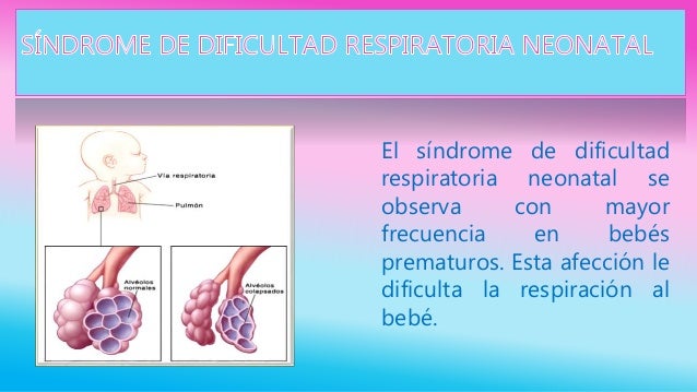 Síndrome de dificultad respiratoria neonatal