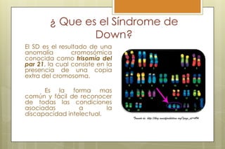 Síndrome de down | PPTX