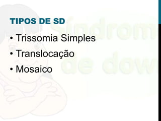 Síndrome de down ou trissomia do cromossoma 21 | PPT