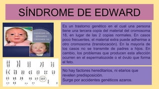 SÍNDROME DE EDWARDS_TRISOMIA 18 (1).pptx