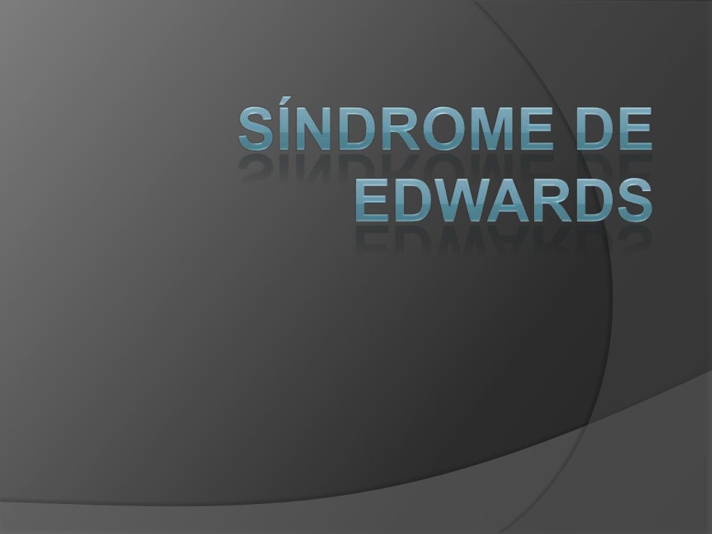 Síndrome de edwards