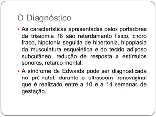 Síndrome de Edwards | PPTX