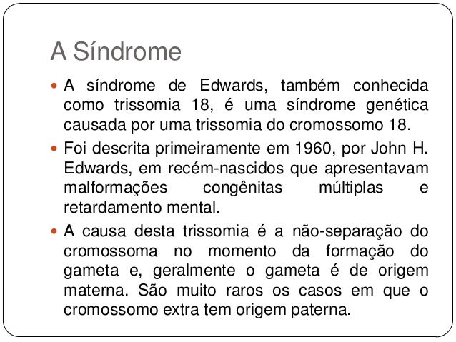 Síndrome de Edwards