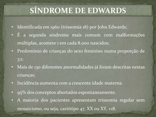 Síndrome de edwards2 | PPTX