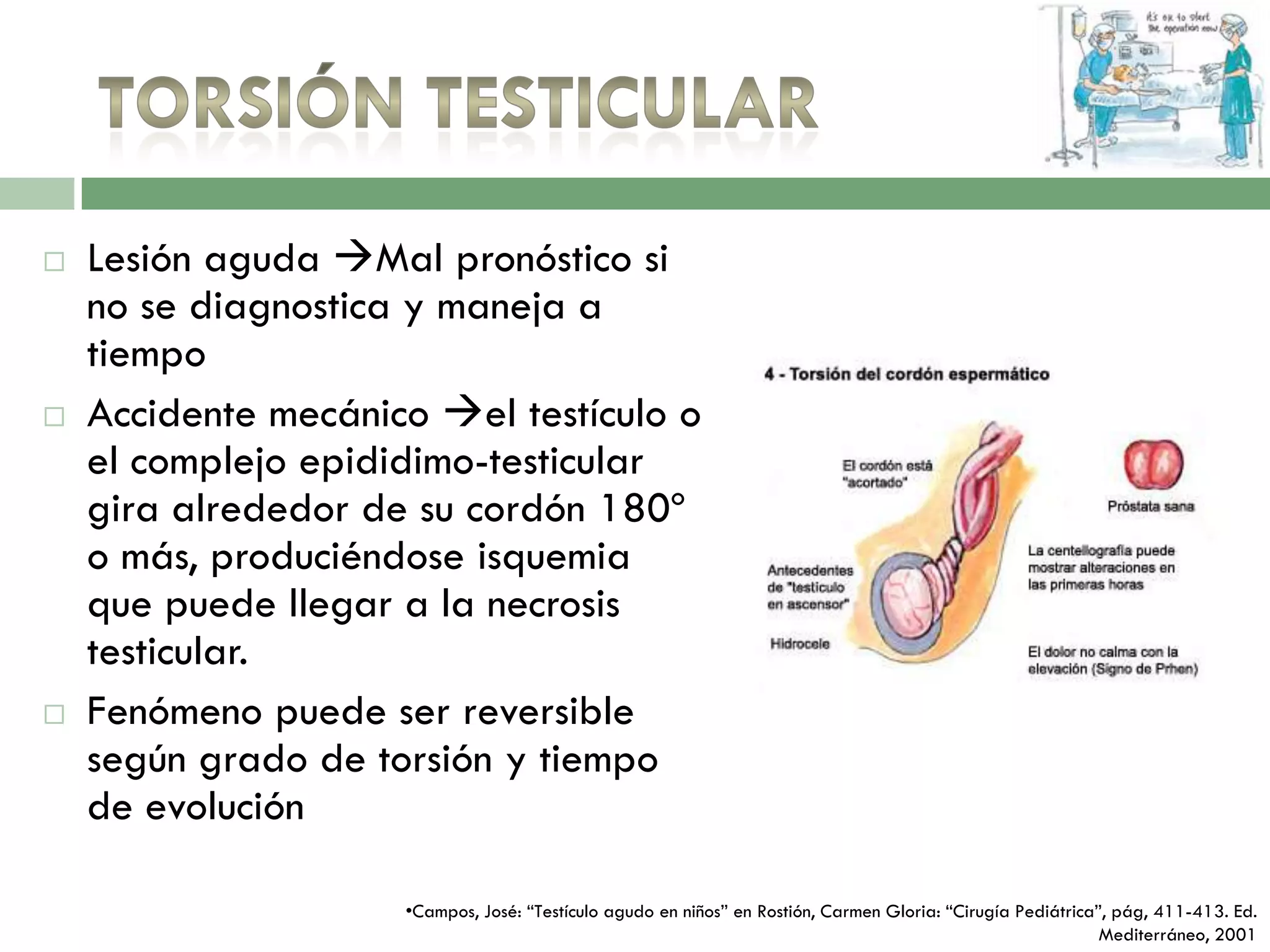 Síndrome de escroto agudo | PPTX
