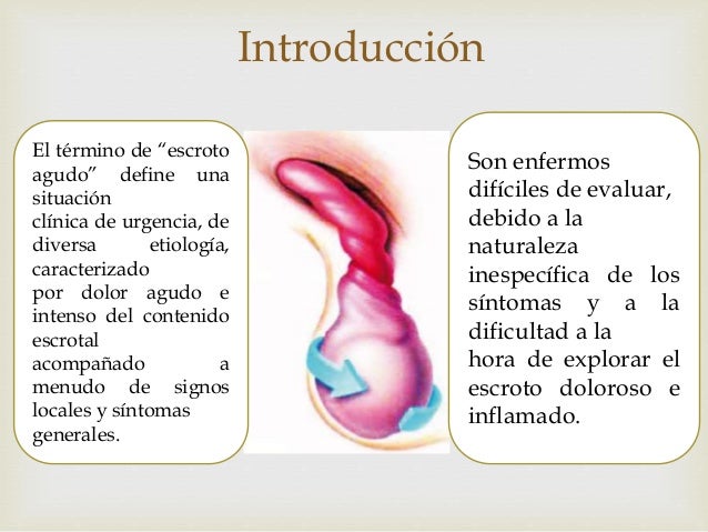 Síndrome de escroto agudo