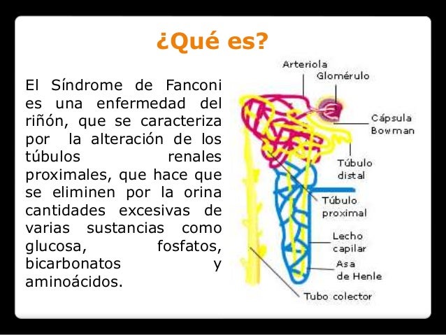 Síndrome de fanconi