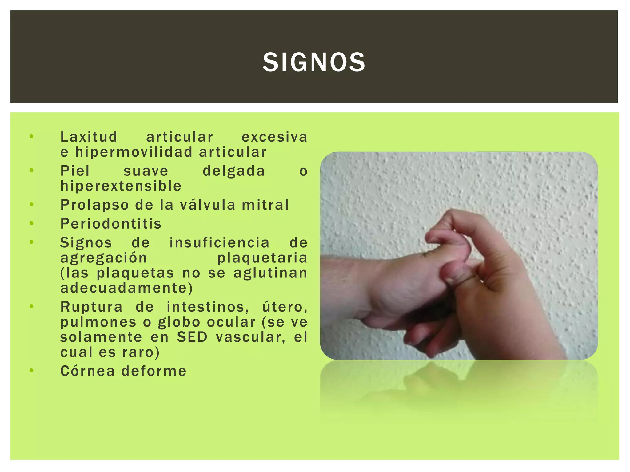 Síndrome de hiperlaxitud articular | PPTX