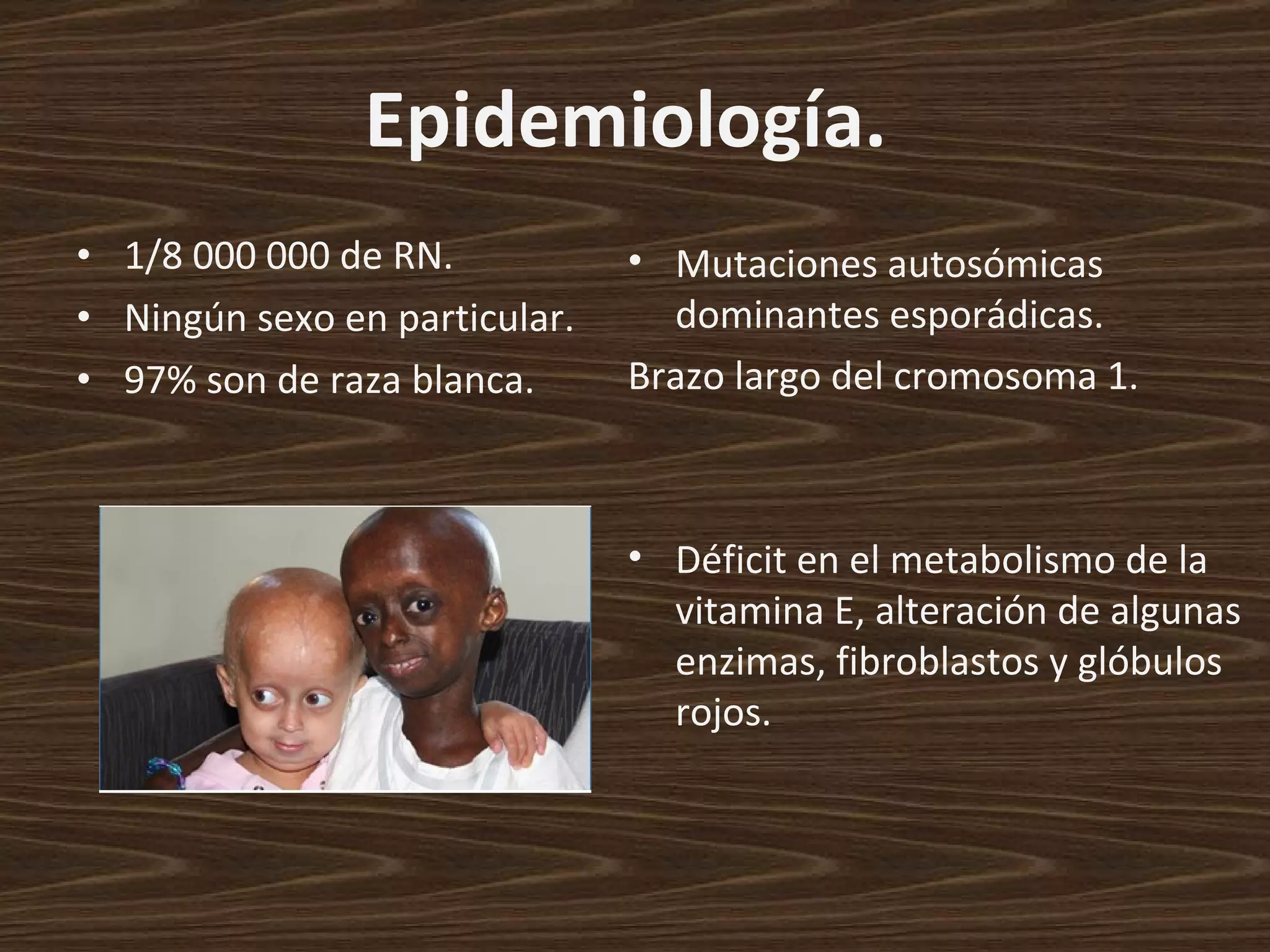 Síndrome de hutchinson Gilford, Progeria | PPT
