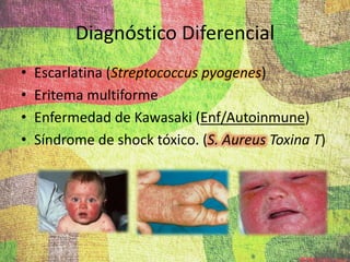 Síndrome de la piel escaldada | PPTX