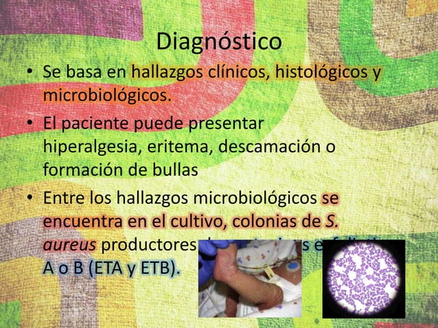 Síndrome de la piel escaldada | PPT