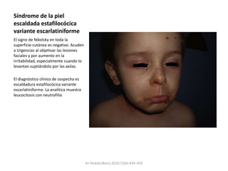 Síndrome de la piel escaldada estafilocócica variante escarlatiniforme ...