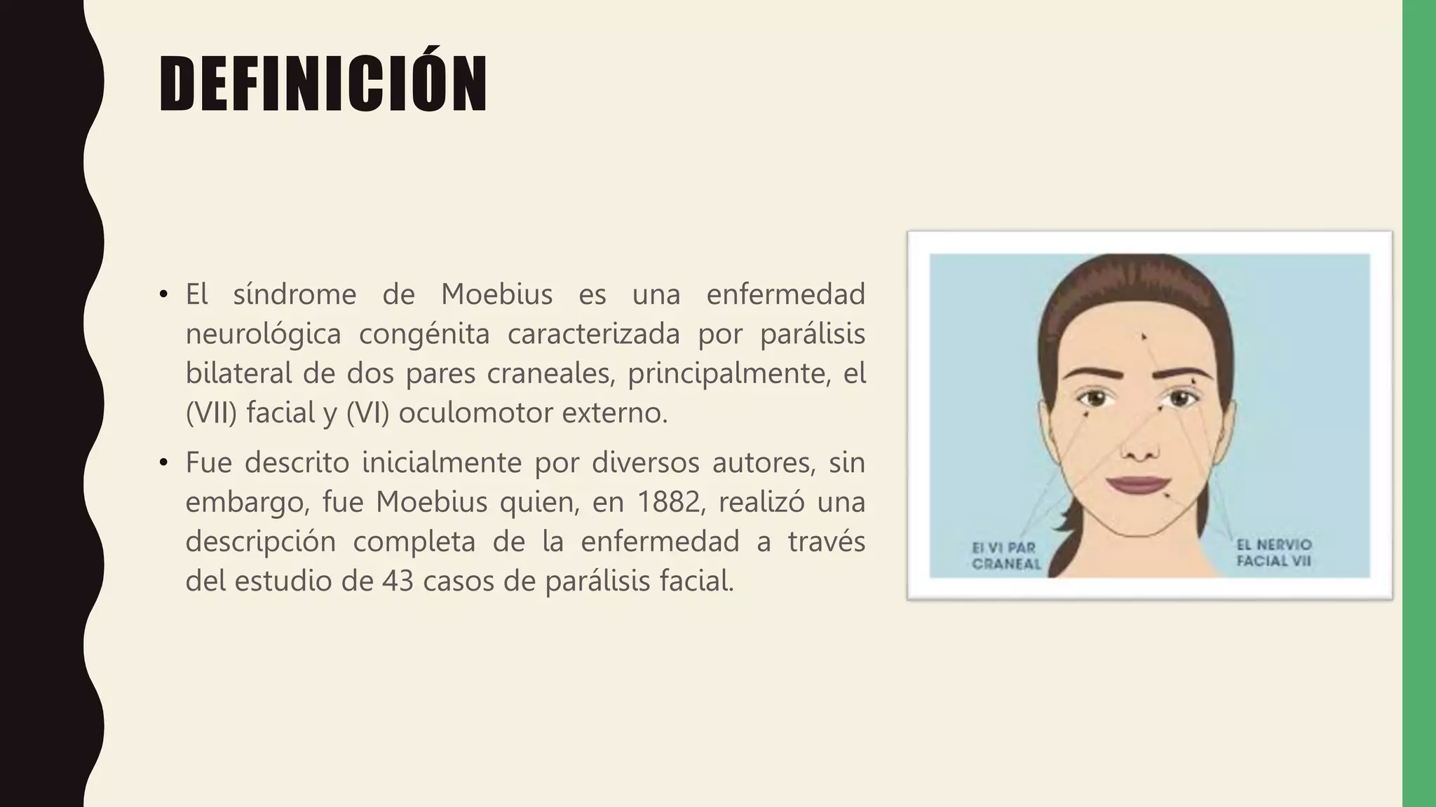 Síndrome de moebius.pptx