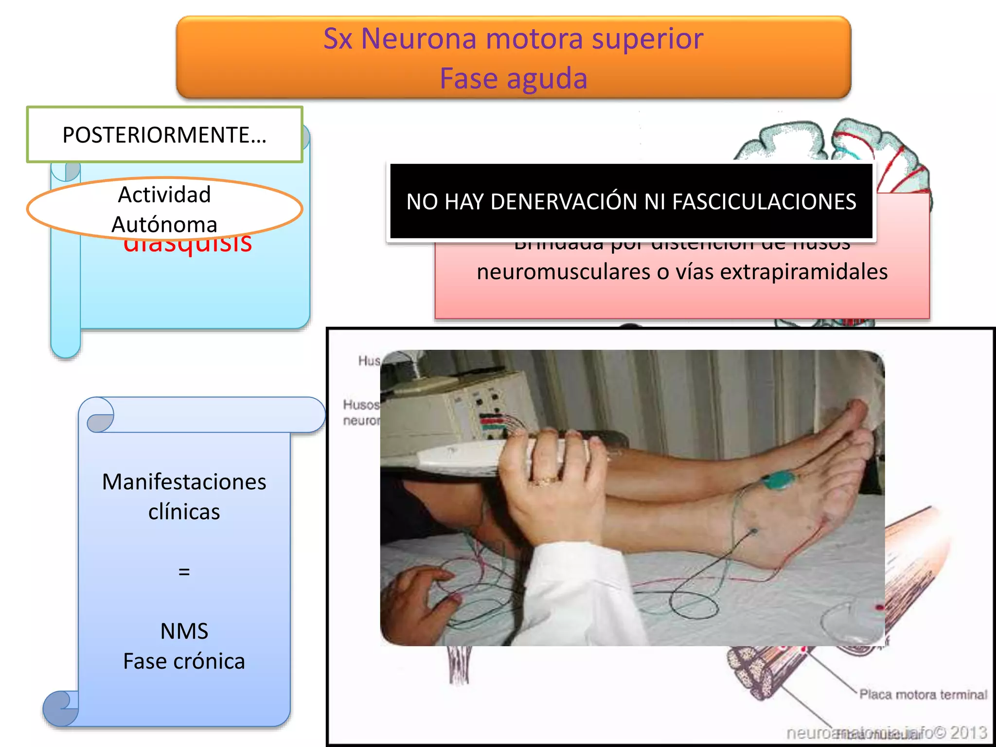 Síndrome de neurona motora superior e inferior | PPT